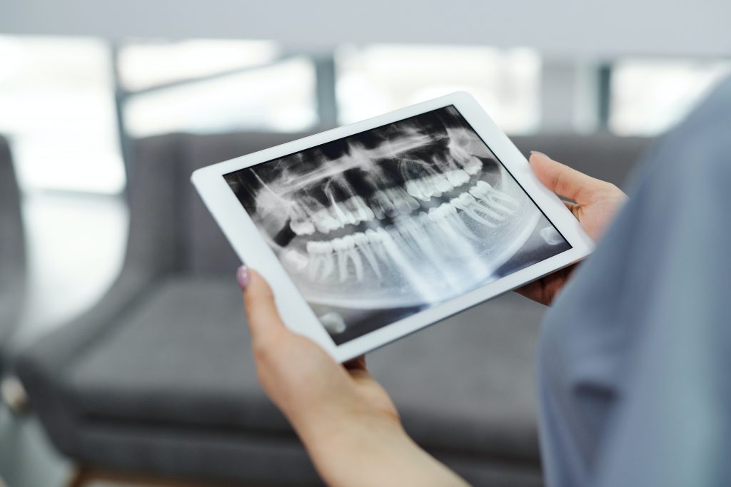 Advanced Technology – Wave Endodontics